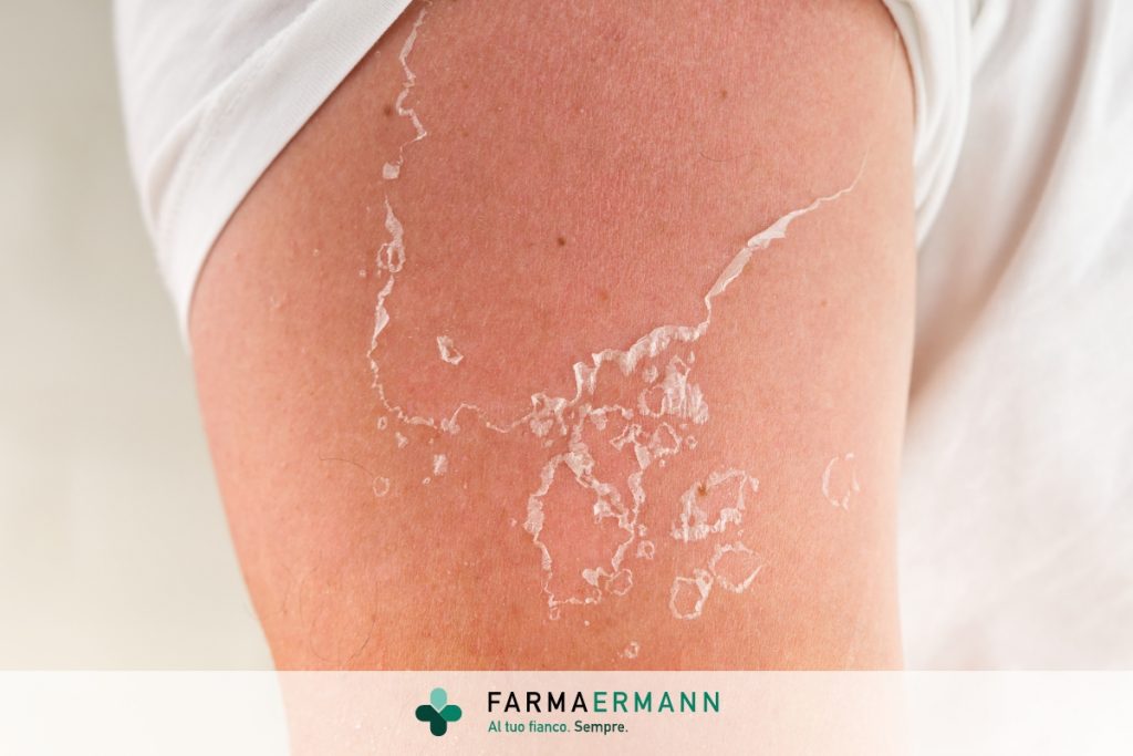 Come togliere la pelle morta dell'abbronzatura - Farmaermann